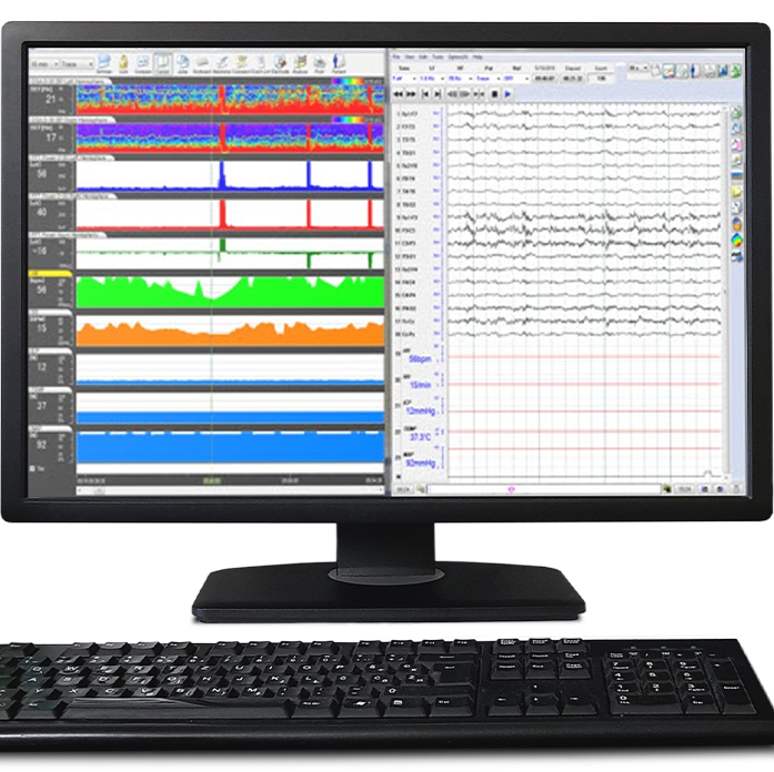 EEG/EMG Software – Berger Medizintechnik GmbH