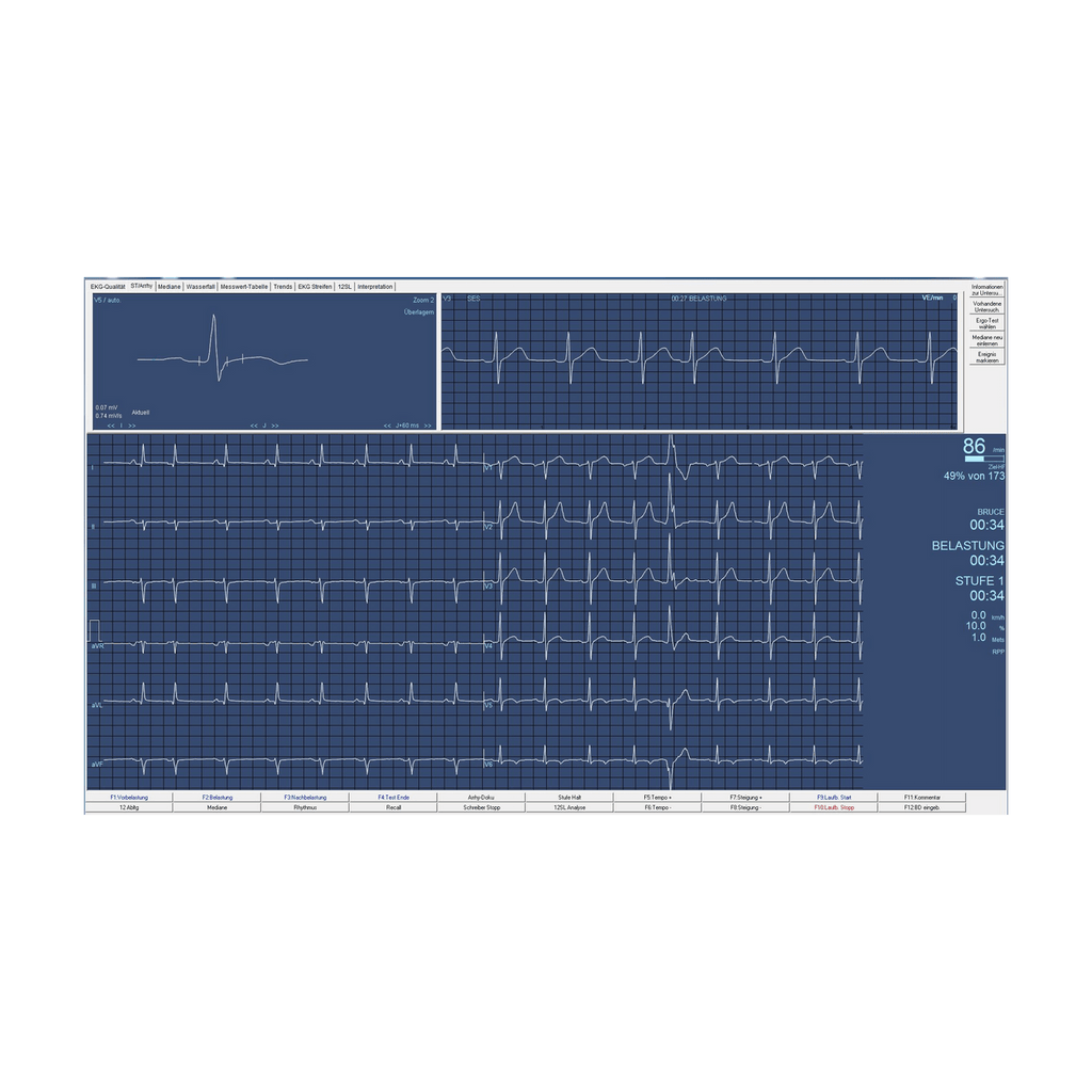 CardioSoft V7 'light' | Berger Medizintechnik GmbH