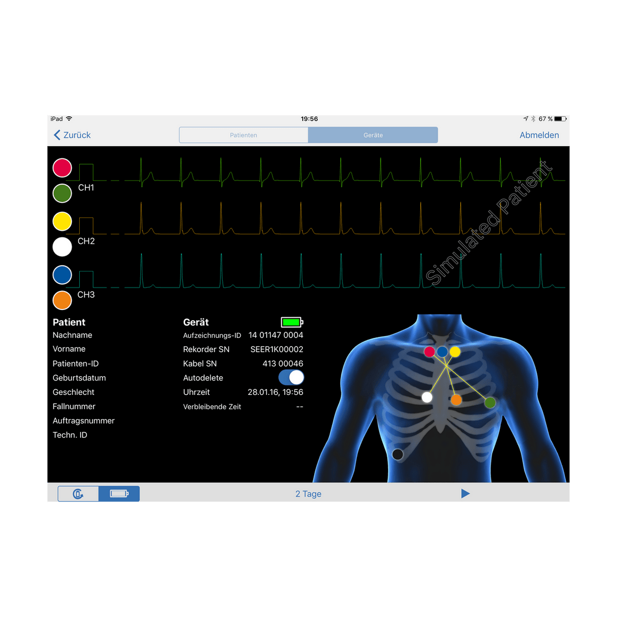 GE Healthcare - SEER™ 1000 - Langzeit-EKG – Berger Medizintechnik GmbH